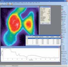 高性能成像及分析软件visiVIEW-适配所有显微镜