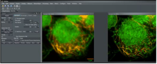 高性能成像及分析软件visiVIEW-适配所有显微镜